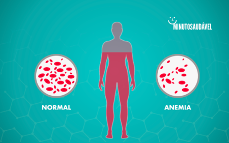 Anemia: tipos, causas, sintomas, tratamentos e o que comer | MS
