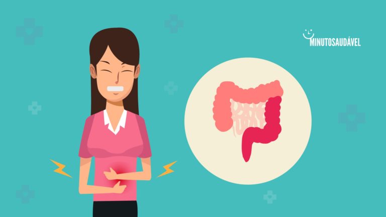 Colite (ulcerativa, isquêmica, distal): sintomas e tratamento | MS