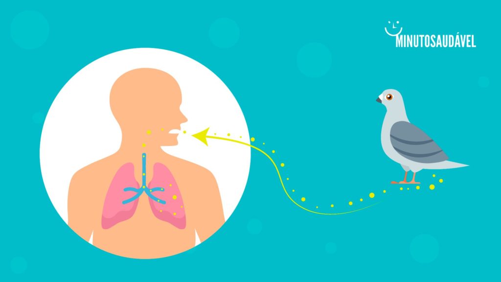 Criptococose (cerebral, pulmonar, em gatos): veja sintomas | MS