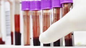 Proteína C-reativa (PCR): o que significa alta ou baixa? | MS