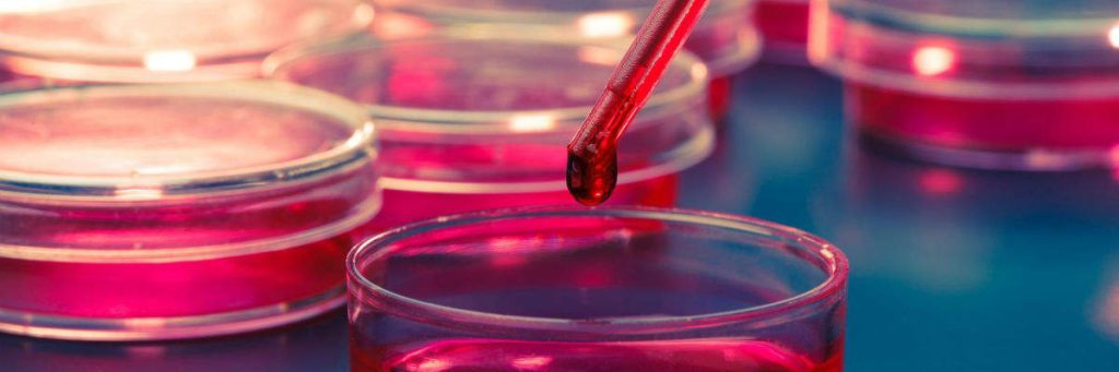 O que é Febre Tifoide? Sintomas, transmissão e tratamento | MS