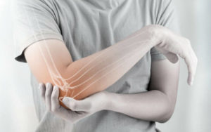 O que é Progéria, causas, no Brasil e expectativa de vida | MS